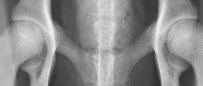 Lonkka- ja kyynärnivellausunnot annetaan röntgenkuvista | Suomen ...